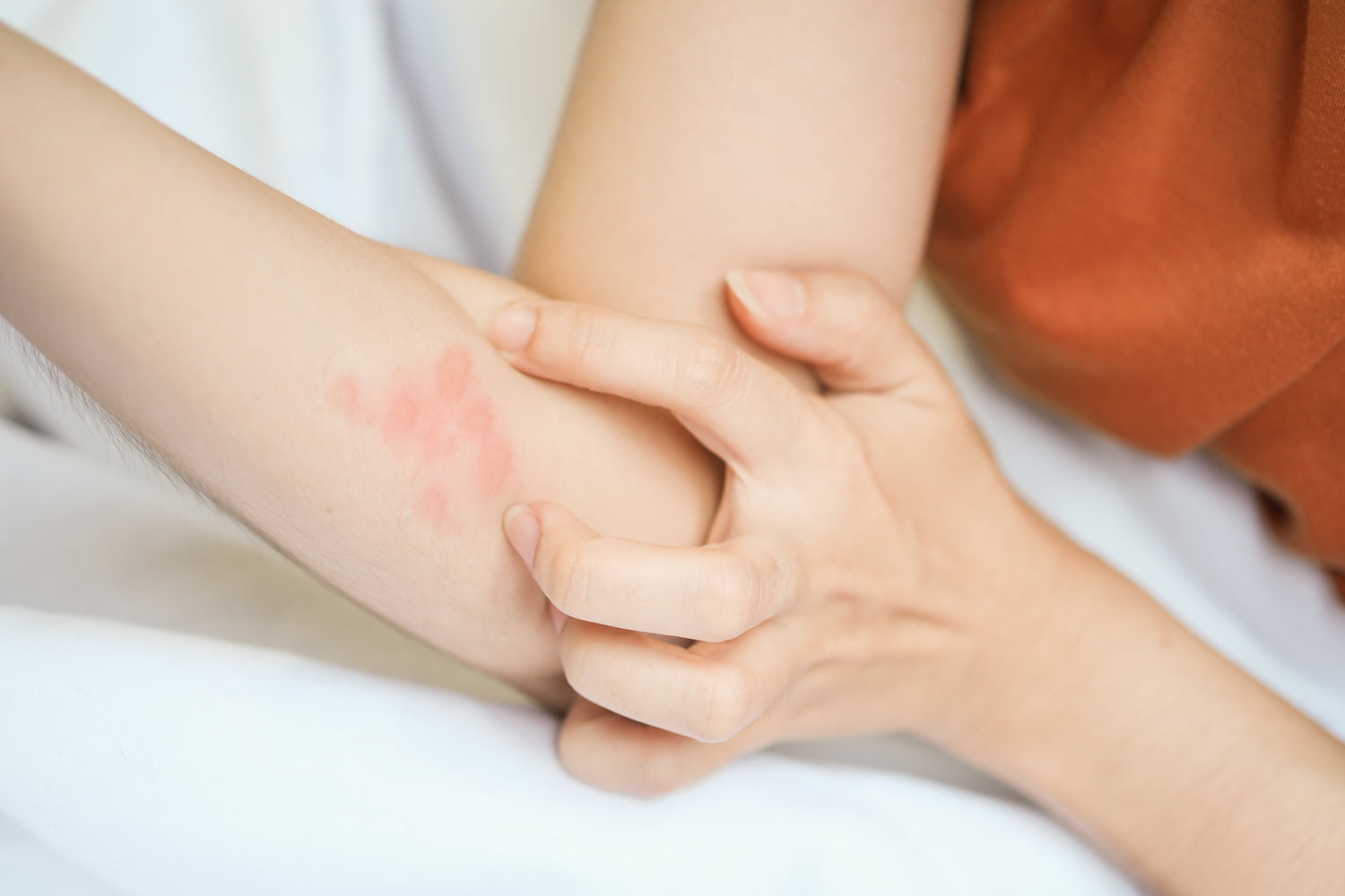 Allergy Test In Senawang | Klinik Casabrina