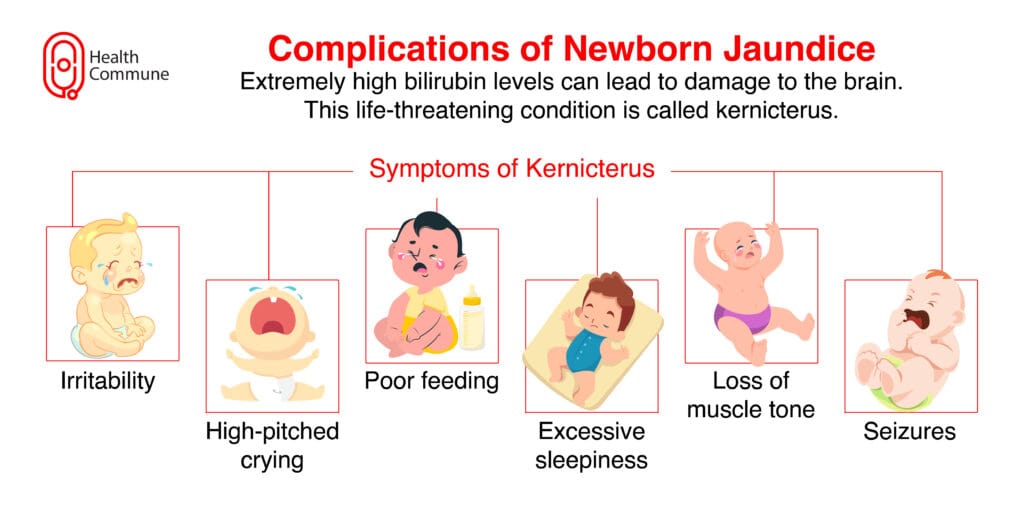 Jaundice Screening In Senawang | Klinik Casabrina